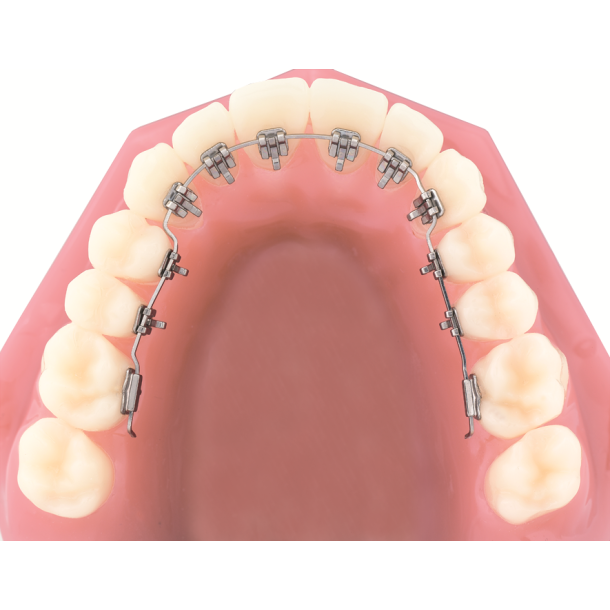Typodont - 2D lingual Brackets