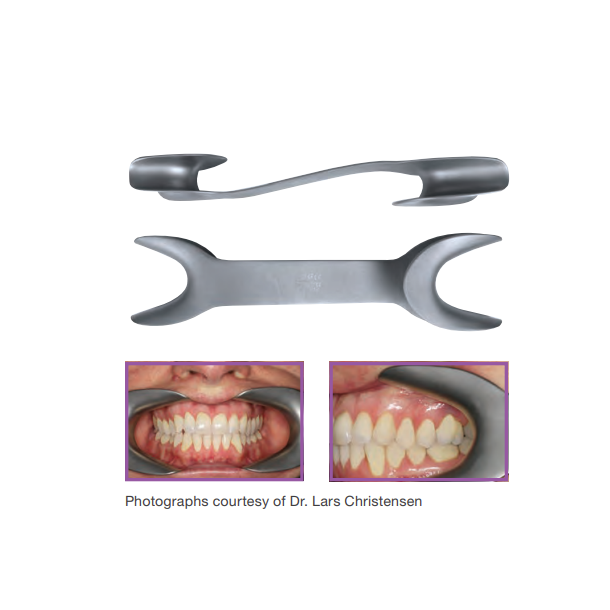 Stainless Steel Cheek Retractor - Mund- og læbeholder - Ortodonti ...