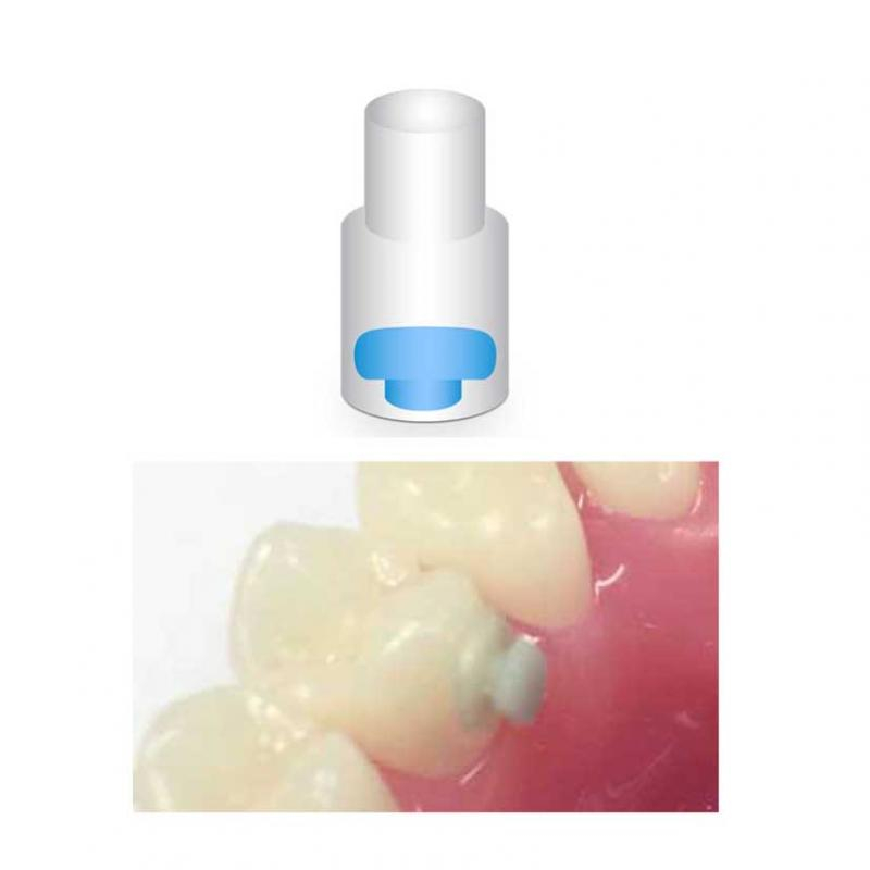 BUTTON MINI MOLD - Buttons - Ortodonti Service A/S